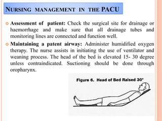 Management Of Patient Undergoing Surgery | PPT