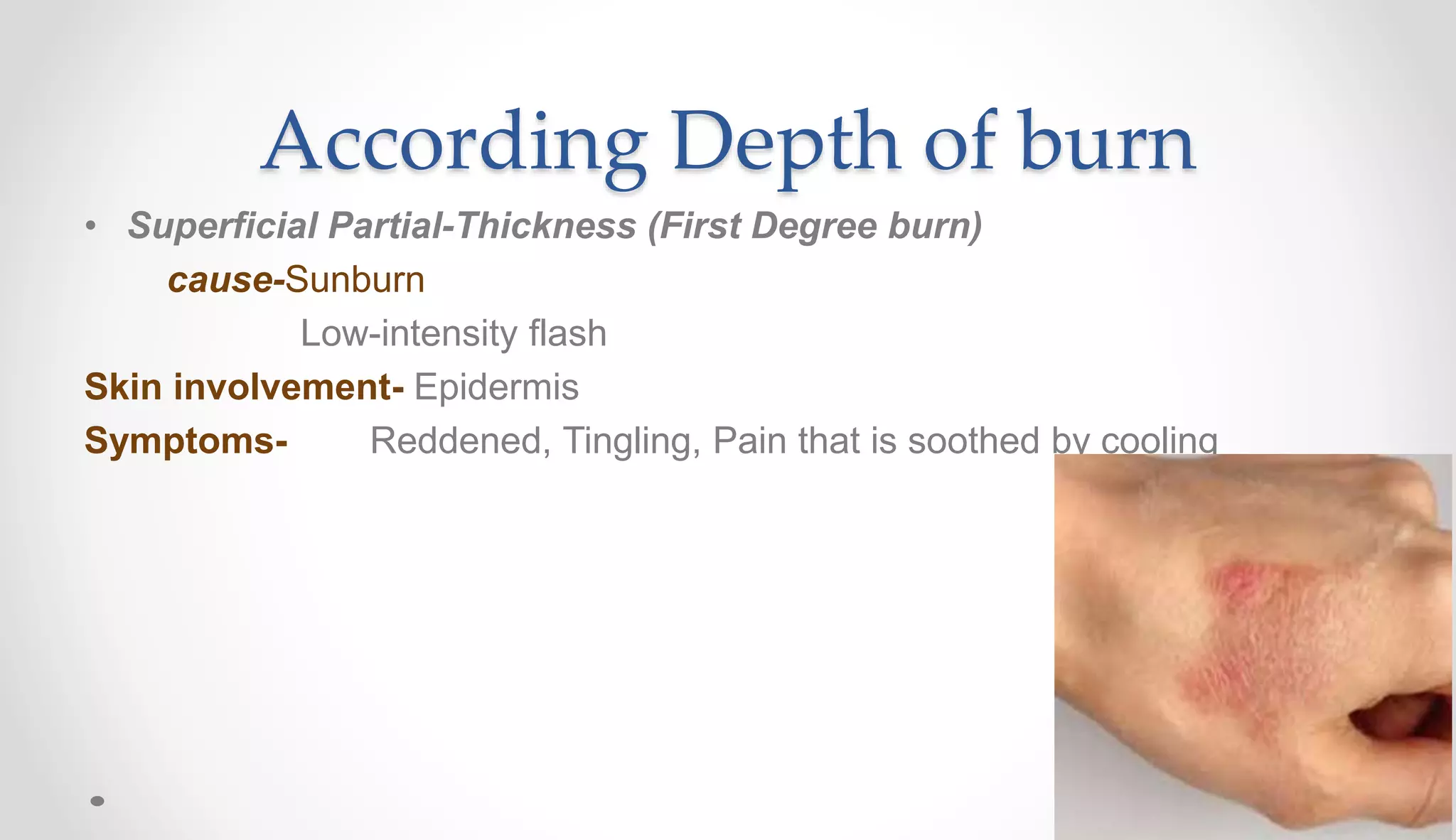 Management of patient with burns | PPTX