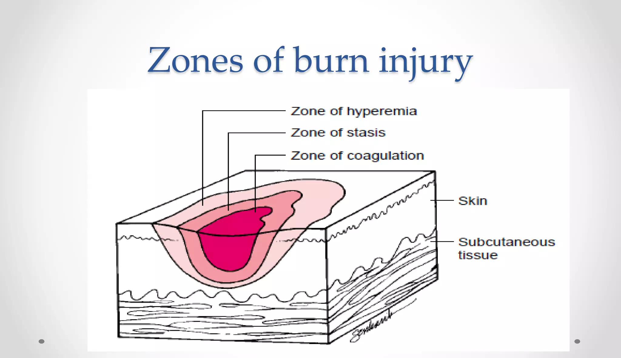 Management of patient with burns | PPTX
