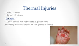 Management of patient with burns | PPTX