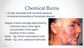 Potassium Hydroxide Burn