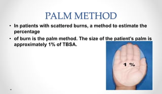 Management of patient with burns | PPT