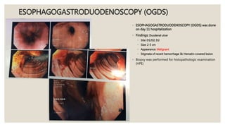 Management of patient with right upper quadrant pain. (desmoplastic ...
