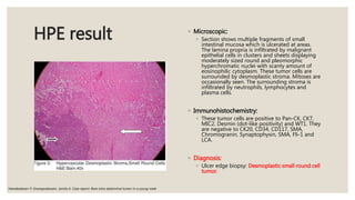 Management of patient with right upper quadrant pain. (desmoplastic ...