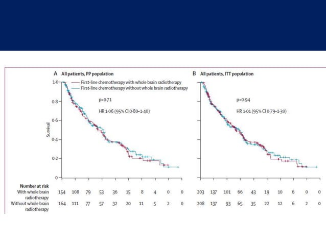 Management of Primary CNS Lymphoma (PCNSL) | PPTX