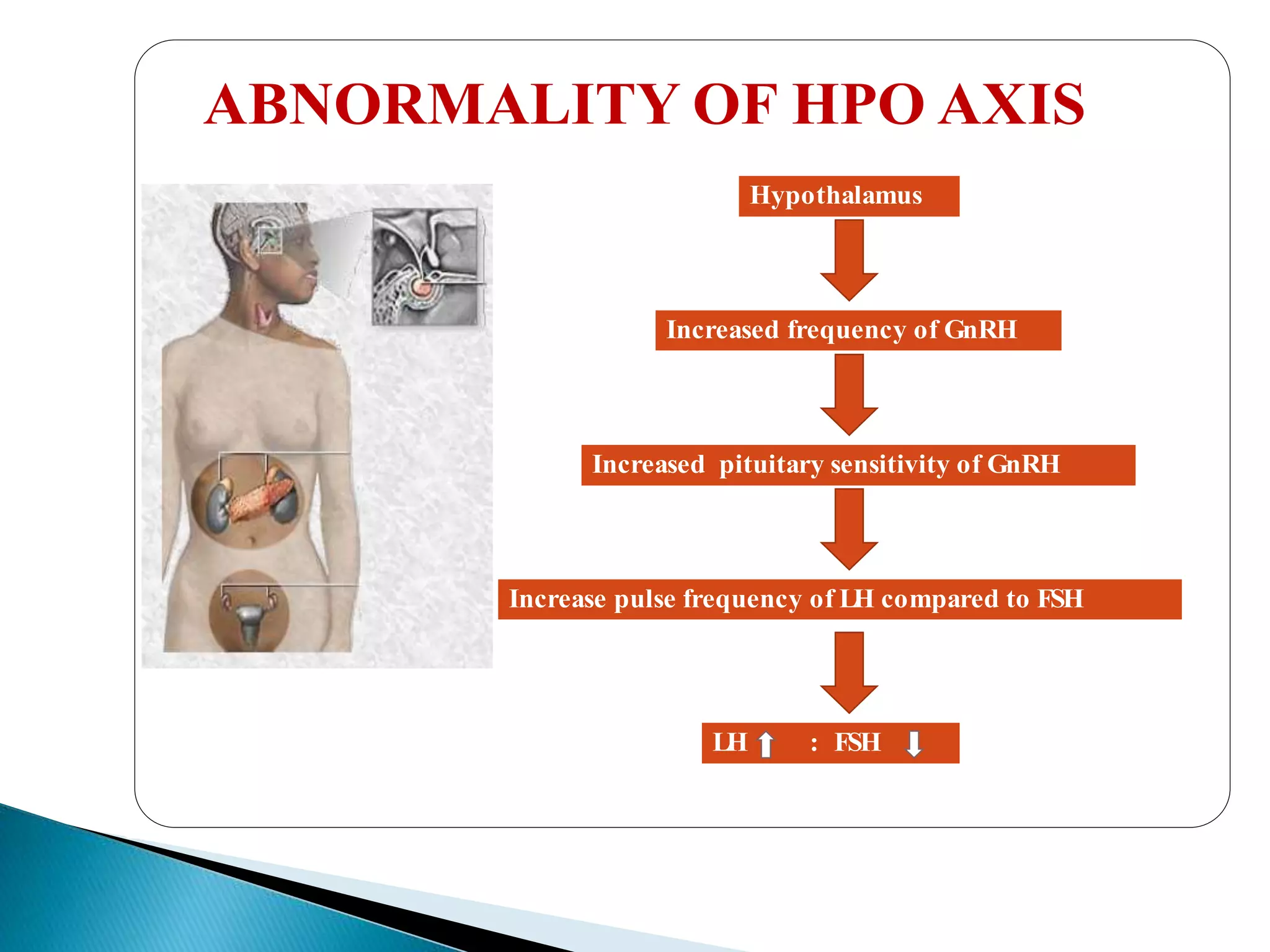 Management of PCOS : ayurvedic perspective | PPTX