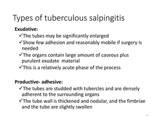 Management of pelvic tuberculosis | PPT