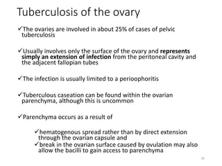 Management of pelvic tuberculosis | PPT