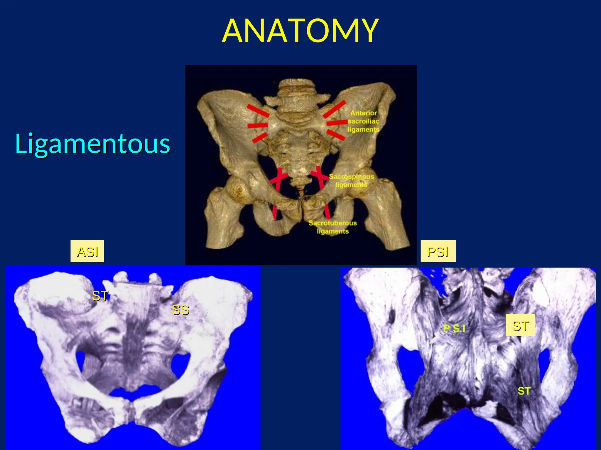 MANAGEMENT OF PELVIC FRACTUREMANAGEMENT OF PELVIC FRACTUREMANAGEMENT OF ...