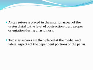 Management of pelviureteric junction obstruction onyeze copy | PPTX