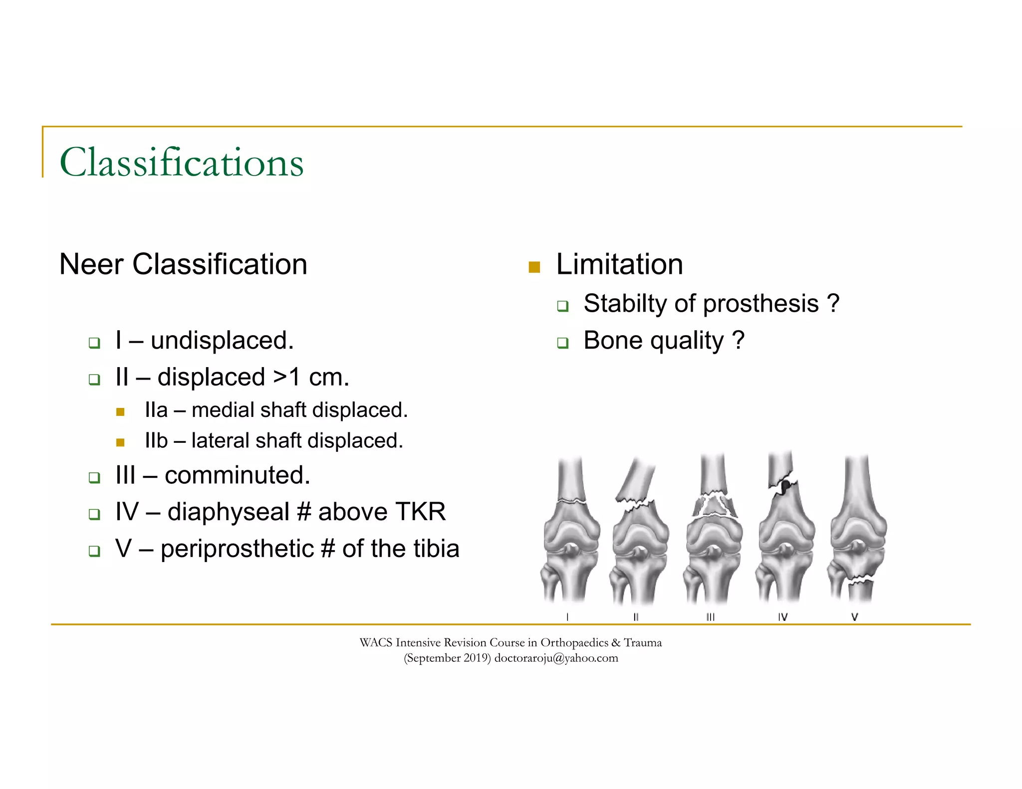 Management of peri prosthetic fractures | PDF