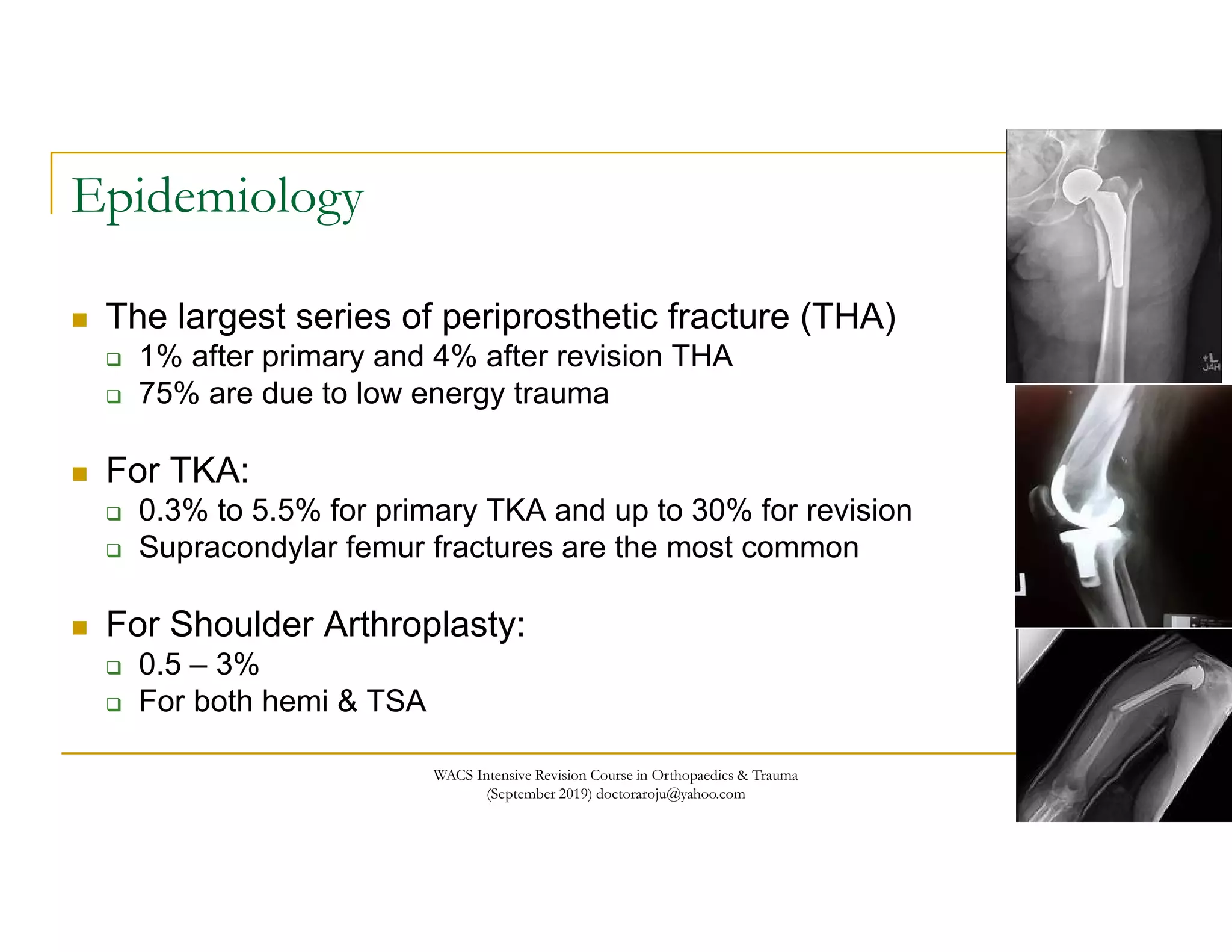 Management of peri prosthetic fractures | PDF