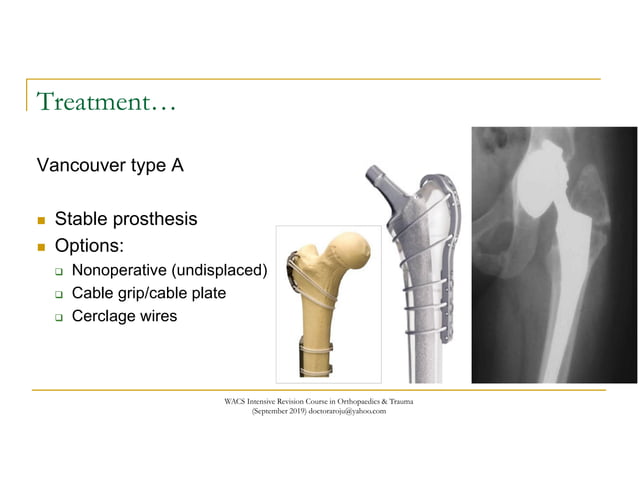 Management of peri prosthetic fractures | PDF