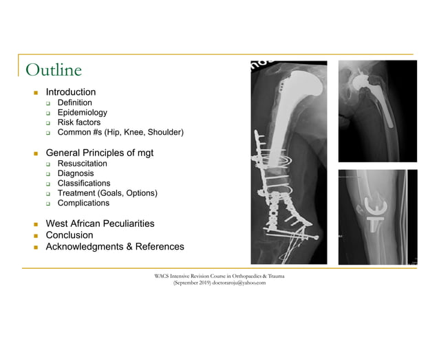 Management of peri prosthetic fractures | PDF
