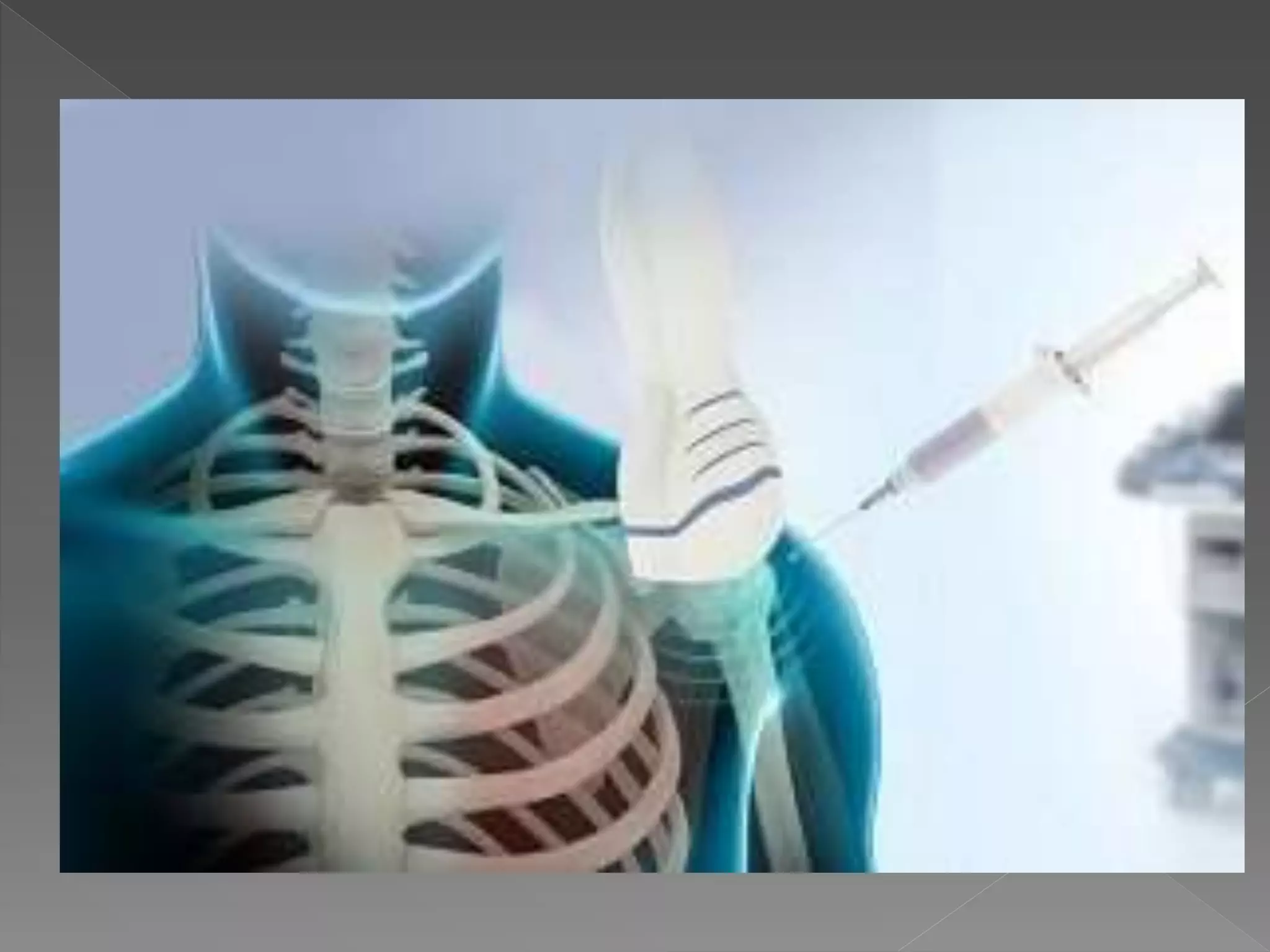 Management of periarthritis of shoulder joint by suprascapular nerve ...