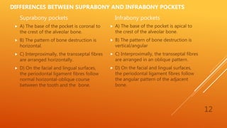 Management of Periodontal Pockets | PPTX
