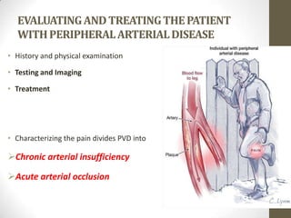 Management of peripheral vascular disease Dr Binaya Timilsina | PPTX