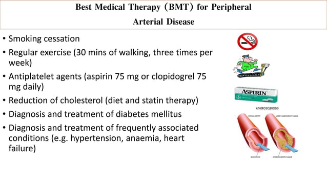 Management of peripheral vascular disease by Sunil Kumar Daha | PPTX
