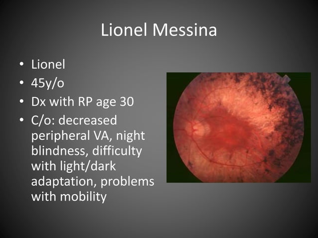 Management of peripheral vision loss | PPT