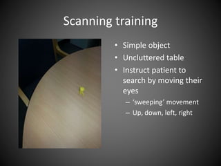 Management of peripheral vision loss | PPTX