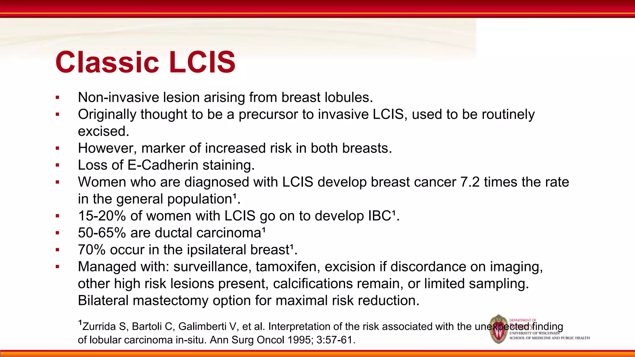 Management of pleomorphic lcis | PPT