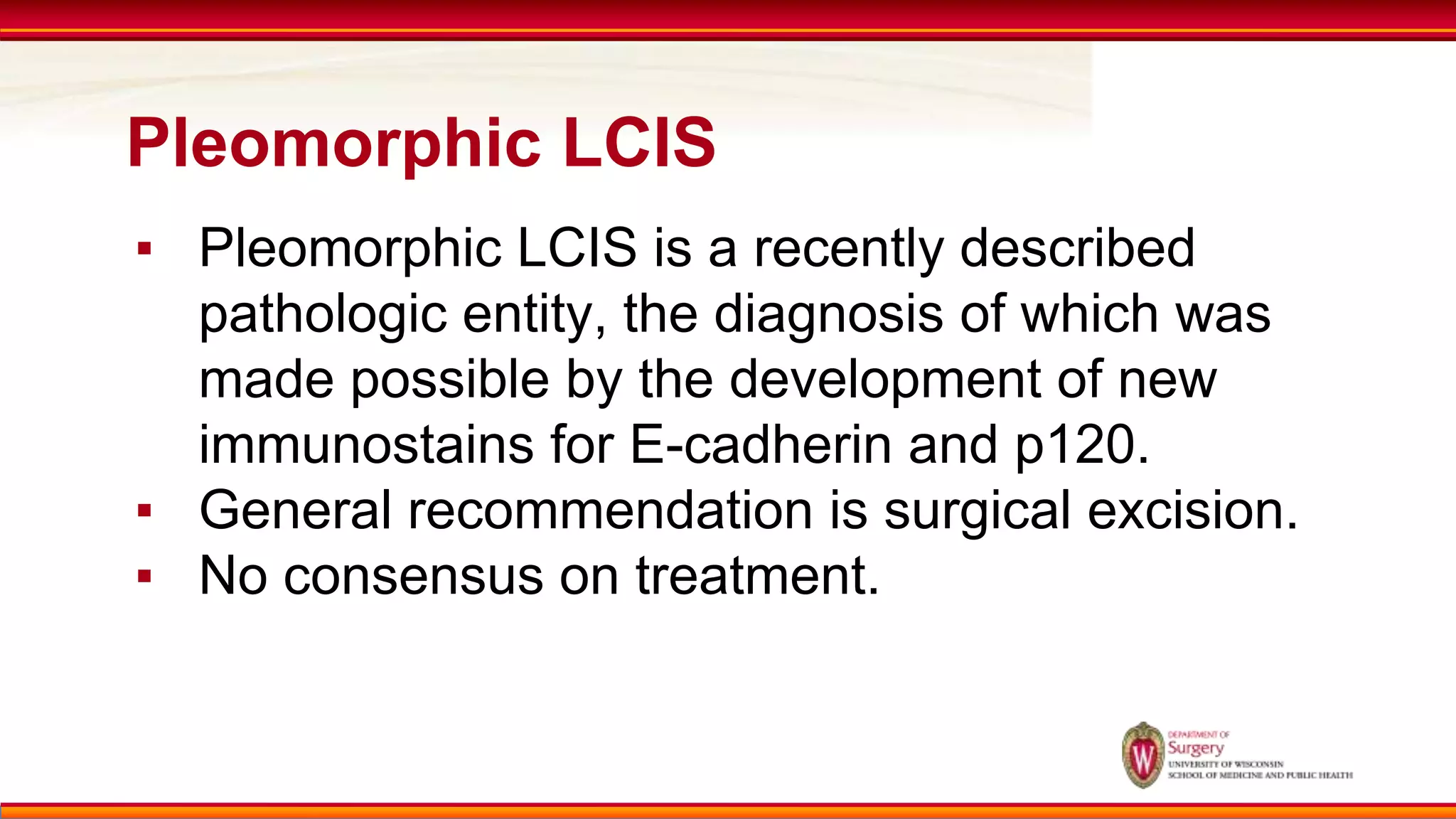 Management of pleomorphic lcis | PPTX