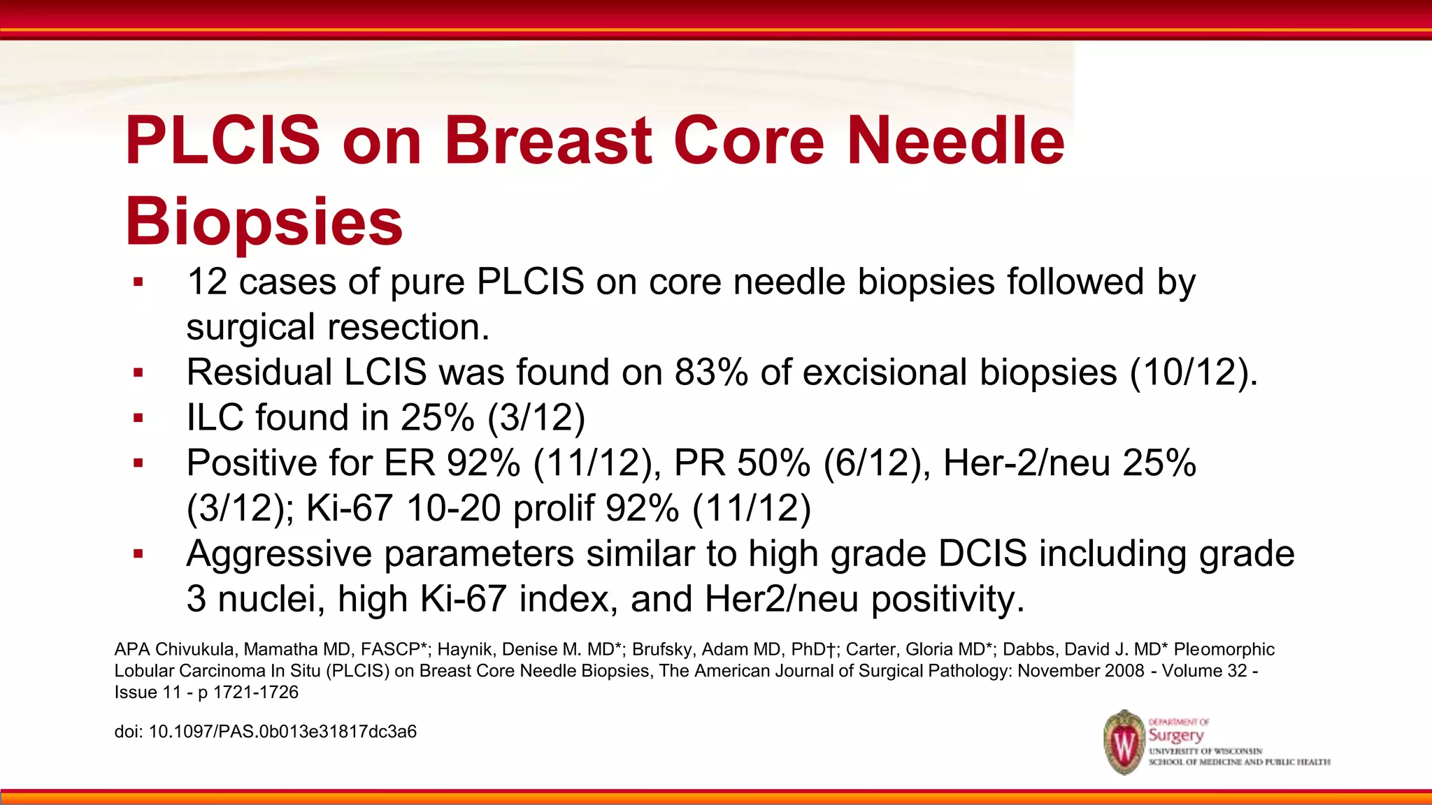 Management of pleomorphic lcis | PPTX