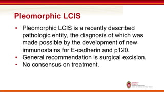 Management of pleomorphic lcis | PPT