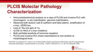 Management of pleomorphic lcis | PPTX
