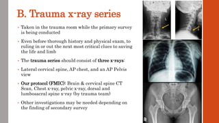 Management of polytrauma.pptx