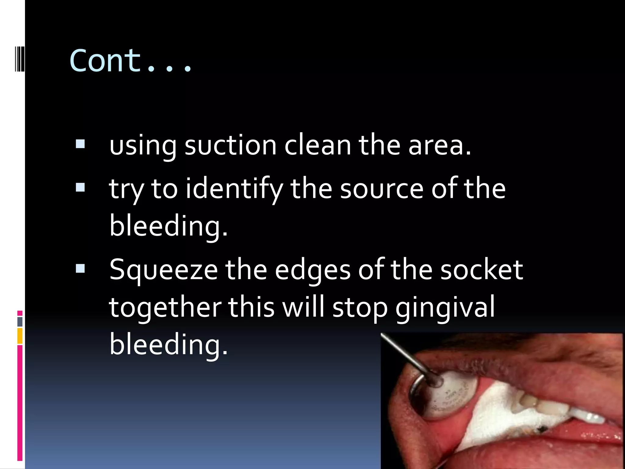 Management of post operative bleeding part | PPTX