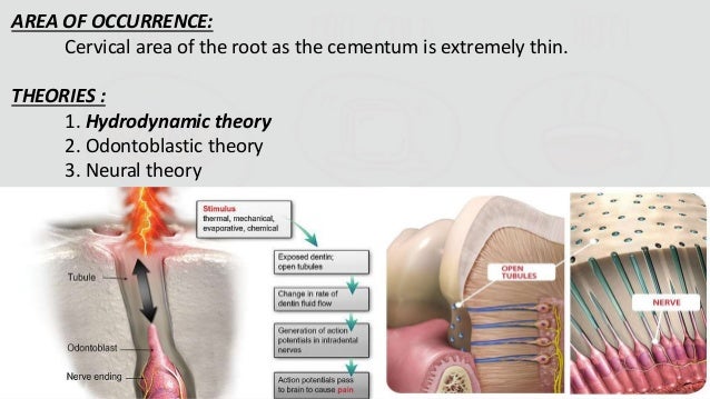 Management of postoperative (root) sensitivity