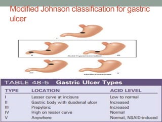 Management of pud | PPT