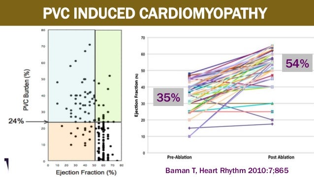 Management of pv cs and ventricular tachycardia in advanced heart fai…