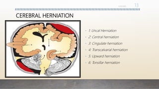 Management of Raised Intracranial Pressure | PPTX