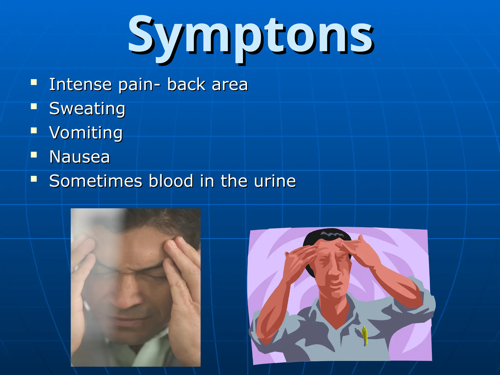 power point presentation on management of RC | PPT