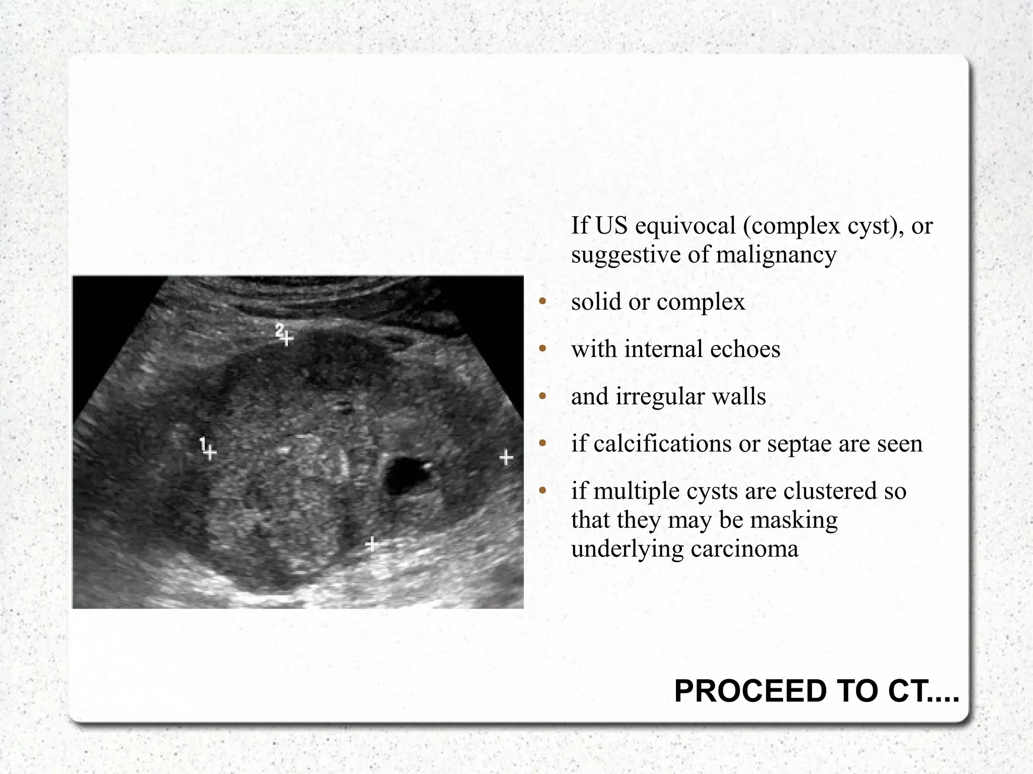 Management of renal cell carcinoma and wilms' tumor | ODP