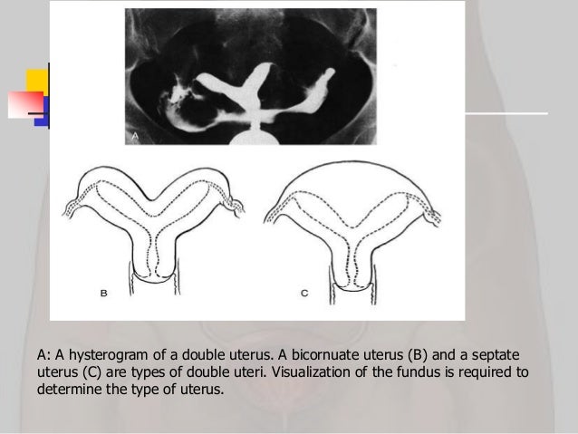 Management of reproductive tract anomalies1