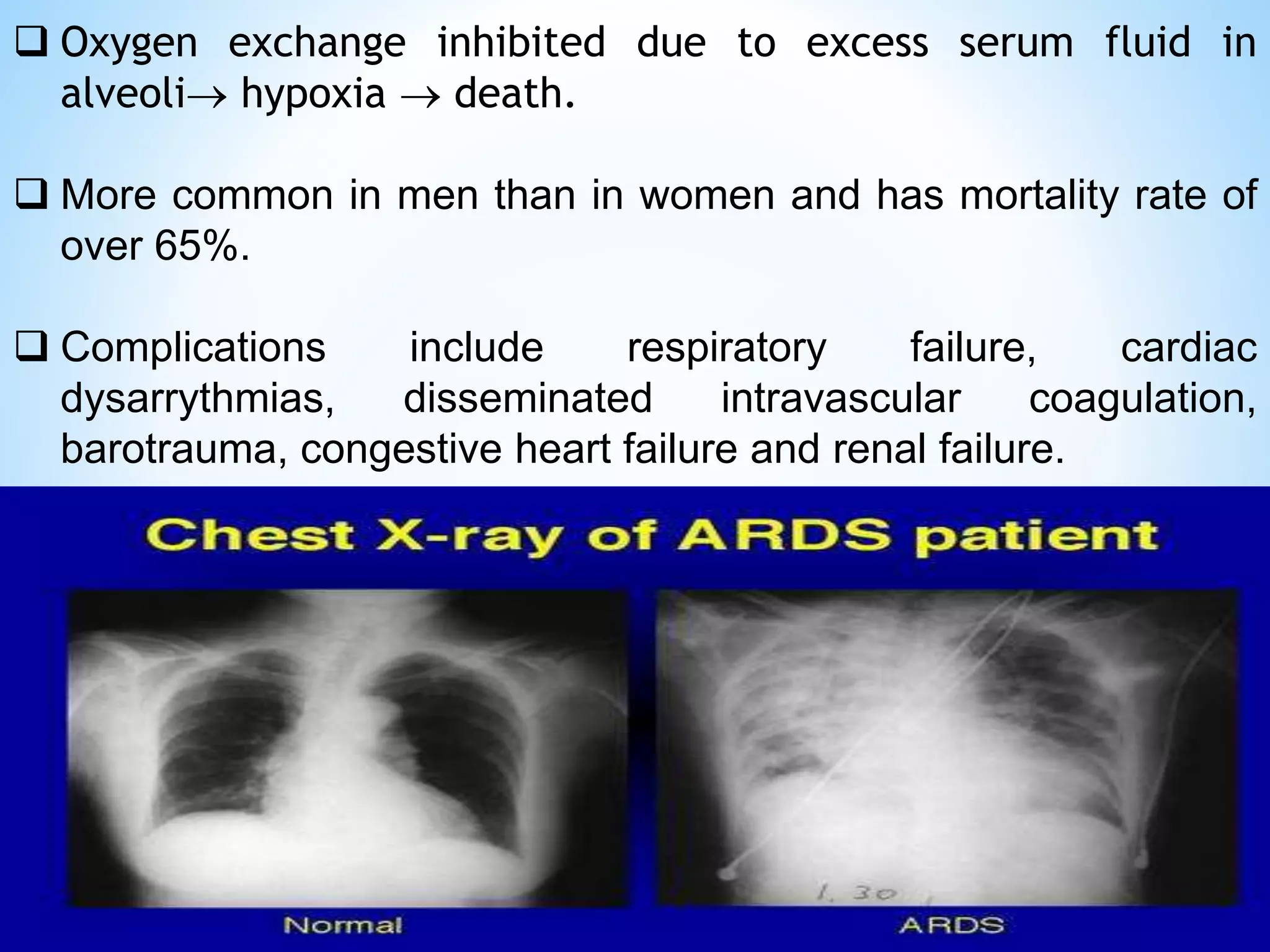 Management of respiratory emergencies | PPTX