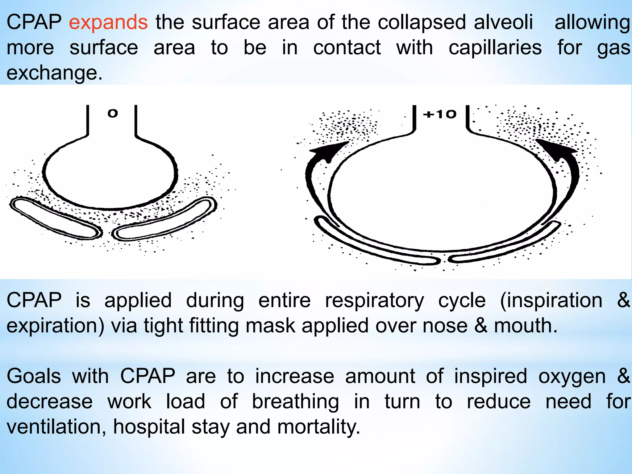 Management of respiratory emergencies | PPTX