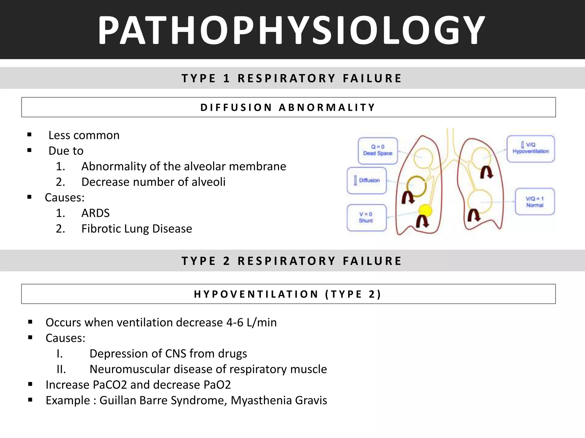 Management of Respiratory Failure | PPTX