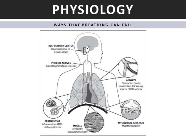 Management of Respiratory Failure | PPTX | Lung and Respiratory Health ...