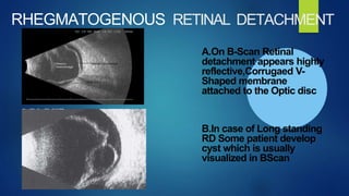 Management of retinal detachment | PPT