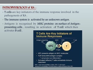 Management of Rheumatoid Arthritis | PPTX
