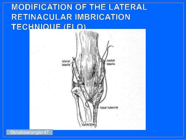 Management of ruptured cruciate ligament in dogs
