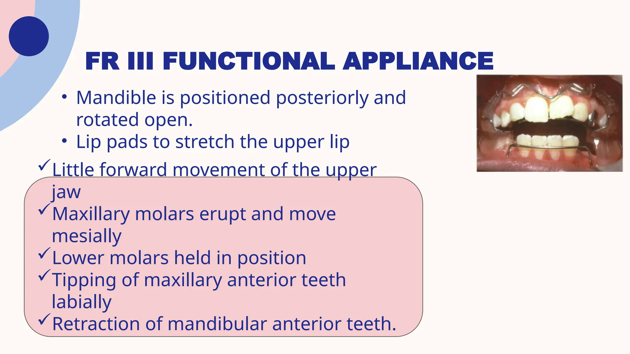 Management of sagittal skeletal problems in children 2.pptx