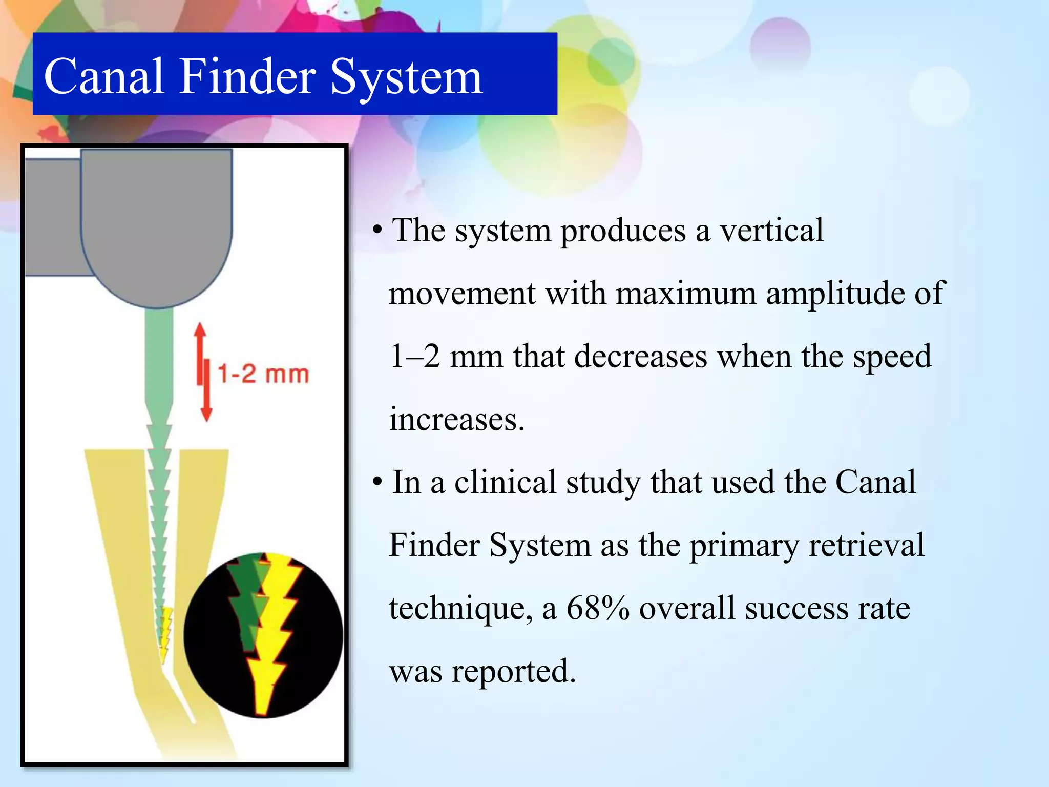 Management of seperated instruments- Dr.Jagadeesh kodityala | PPTX