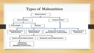 Management of Sever Acute Malnutrition.pptx