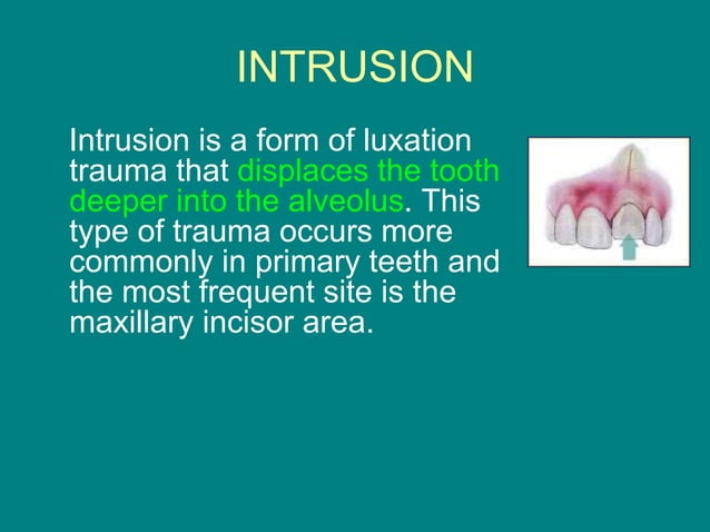 Management of severely intruded central incisor 1 | PPT