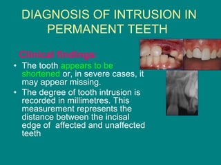 Management of severely intruded central incisor 1 | PPT